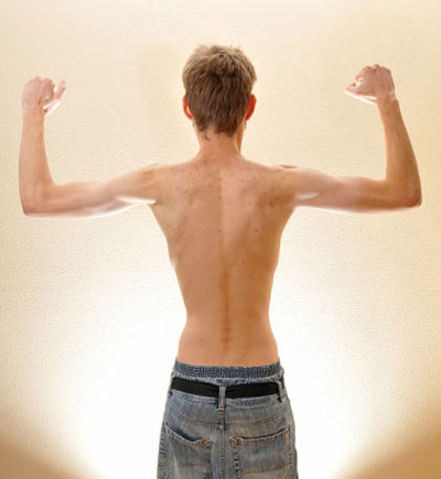 اندام لاغرم را دوست ندارم، میخواهم چاق شوم! - زیبان | لیزر مو | تزریق ...